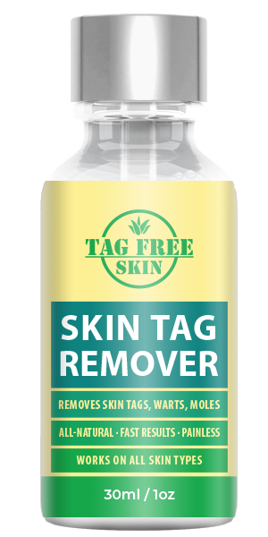 New Customers Claim Limited Bottle of Tag Free Skin Tag Remover